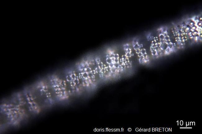 Beggiatoa mirabilis | DORIS