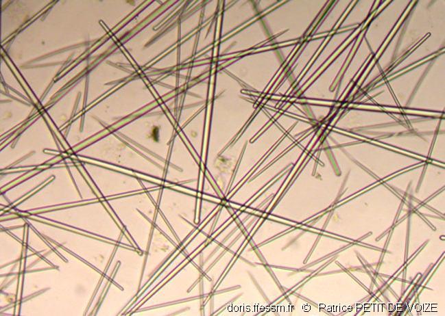 Polymastia boletiformis | DORIS